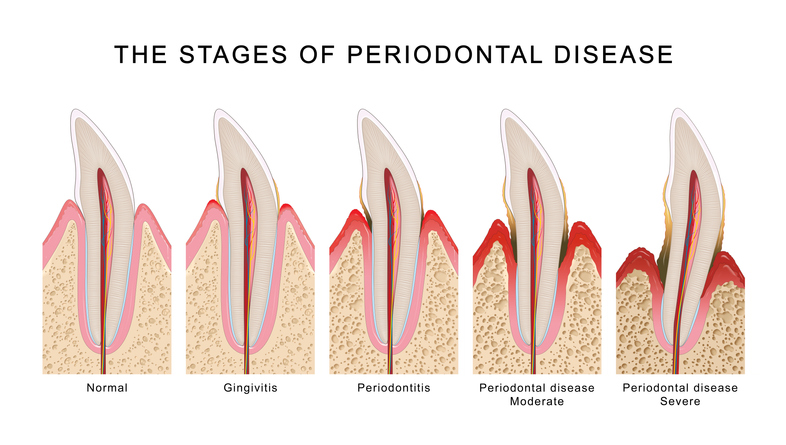 Why Do My Gums Hurt? Reasons and Treatment - Insider Envy